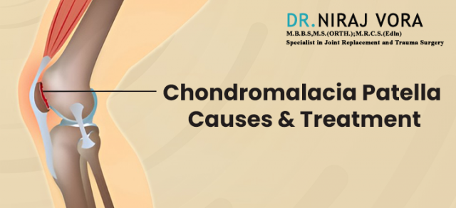 Chondromalacia Patella Causes & Treatment