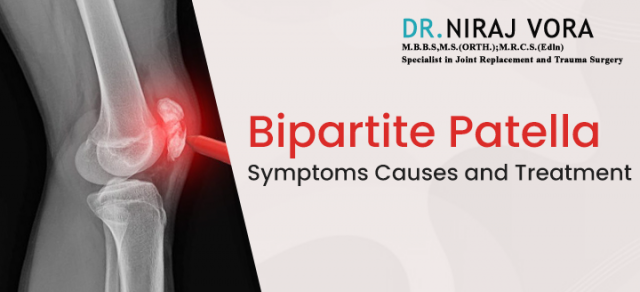 Bipartite Patella Symptoms Causes and Treatment